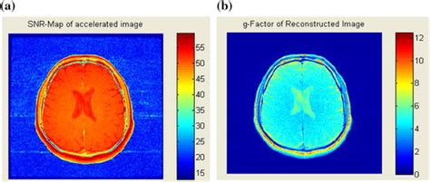 A Snr Map Of The Reconstructed Image Of Fig 8 And B The Corresponding Download Scientific