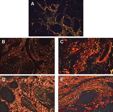 Representative Picrosirius Red Staining Of Different Salivary Gland