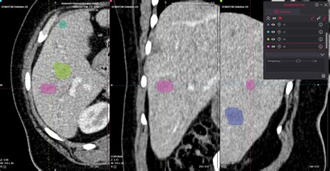 Imaging Core Lab Advancing Clinical Trials Through Expert Medical