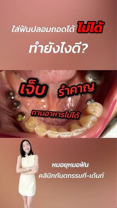 ใส่ฟันปลอมถอดได้แล้วเจ็บ ทำยังไงดี ฟันปลอม ฟันหลอ รากเทียม ฟันปลอม