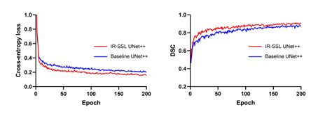 Ultrasound Carotid Plaque Segmentation Via Image Reconstruction Based Self Supervised Learning