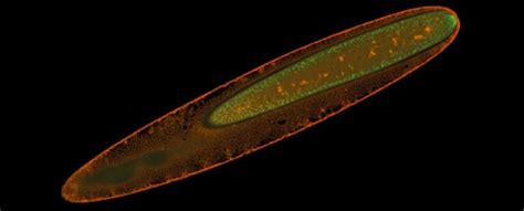 Giant Bacteria Visible To The Naked Eye Has A Never Before Seen Type Of