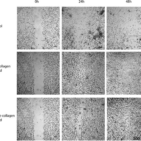 In Vitro Scratch Wound Closure Assay Using L929 Fibroblast Cell Line