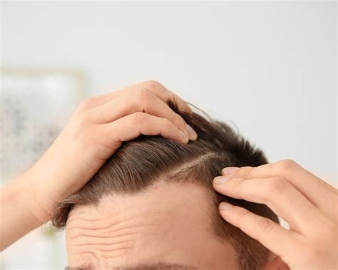 10 Best Mens Hairstyles For Receding Hairline Salt Grooming