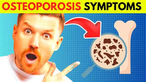Early Warning Signs Of Osteoporosis You Need To Know Youtube