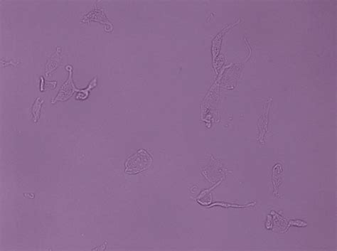 Comparison Of Cell Morphology Before And After Exposure To H2O2 Download Scientific Diagram