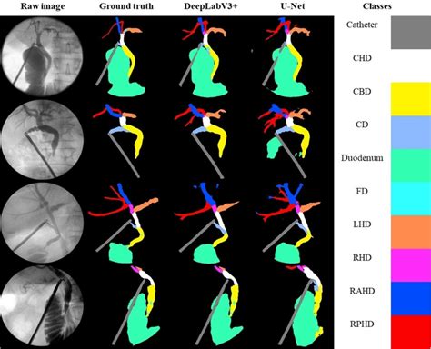 Examples Of Convolutional Neural Network Cnn Generated Masks Compared Download Scientific