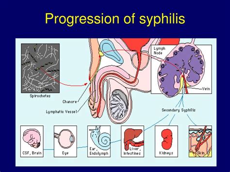 Ppt Curable Versus Incurable Stds Powerpoint Presentation Free Download Id 391739