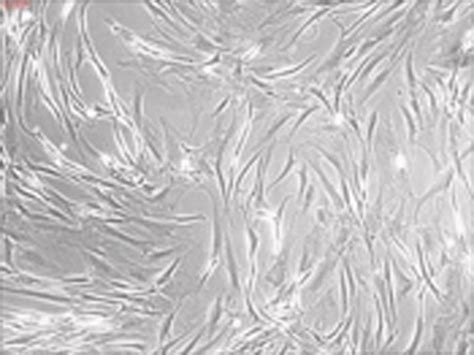 Shows Subcutaneous Adipose Tissue Mesenchymal Stem Cells Scat Which