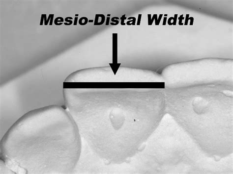 Tooth Dimensions To Be Measured Download Scientific Diagram