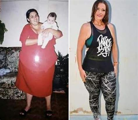 Mulher Emagrece Mais De 100 Kg Apenas Praticando Zumba Tem Londrina