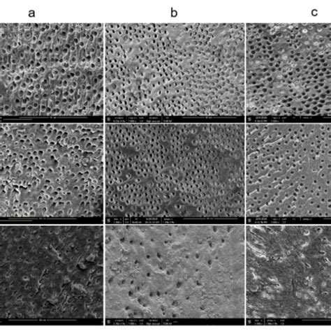 Representative Scanning Electron Microscopy Micrographs Of Longitudinal