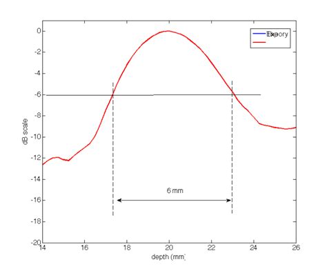 Normalized Axial Pressure Amplitude Ref 25 Mpa The Pressure Field