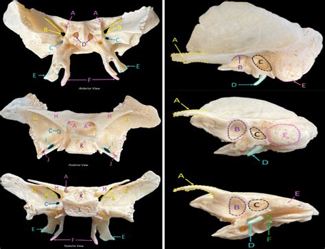 Lab 2 Sphenoid And Temporal Bone Diagram Quizlet