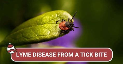 Symptoms Of Lyme Disease From A Tick Bite