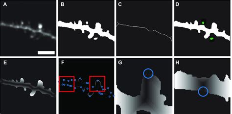Steps In Image Segmentation A Original Image B Thresholding Using Download Scientific