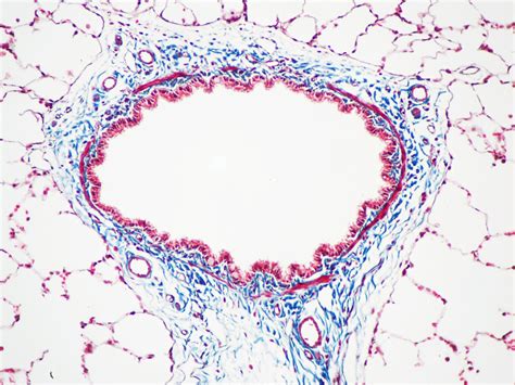 Massons Trichrome Staining Principle Procedure Result Uses Biology Notes Online