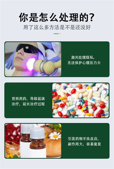 百草真菌王 止痒抑菌软膏 配方升级效果加强 新款货源 一件代发 阿里巴巴