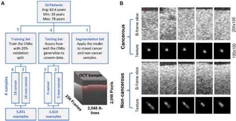 Dataset Description And Visualization A The Dataset Of 10 Patients