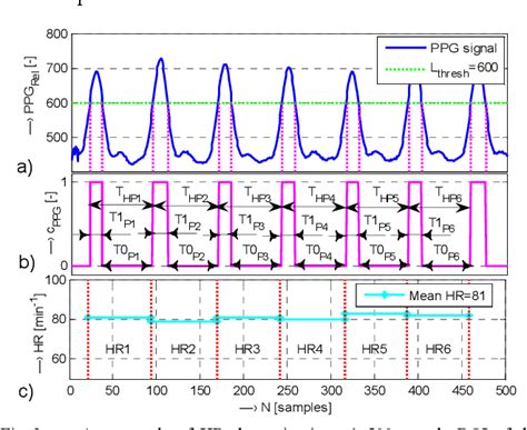 Figure 1 From Wearable Ppg Sensor With Bluetooth Data Transmission For Continual Measurement In