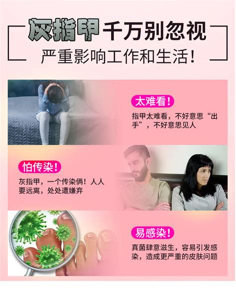 灰指甲抑菌专用液脱甲液脱甲软精油凤仙草浓缩型抑菌液现货批发 阿里巴巴