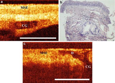 OCT In Gynecology Ento Key