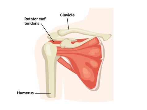 Arthroscopic Rotator Cuff Repair Treatians