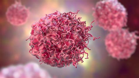 Abbvies Teliso V Succeeds Across Key Nsclc Endpoints