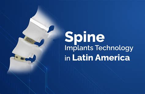 Spine Implants Technology In Latin America Zealmax Ortho