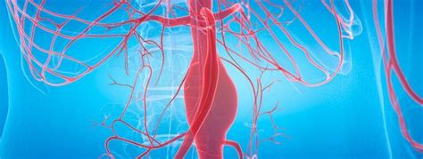 Tipos De Aneurisma Síntomas Y Características Mentes Analíticas