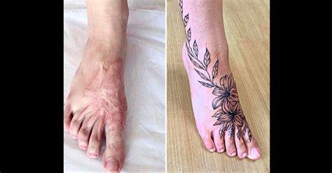 25 People Who Turned Their Scars Into Works Of Art