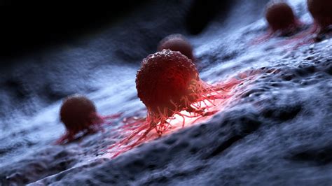 Ce nouveau médicament se révèle prometteur contre les cancers du pancréas et du sein