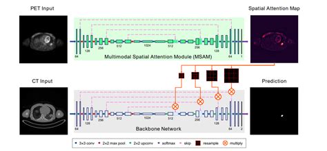 GitHub HodayaPinian PET CT Segmentation Explore Segmentation Method For PET CT Images