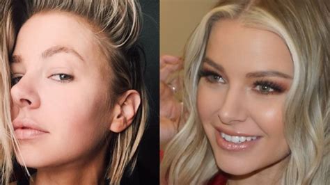 Ariana Madix Nose Job Before And After Plastic Surgery