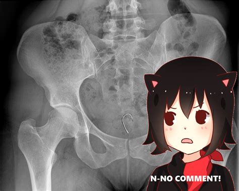 Meta Slower Than A Snail