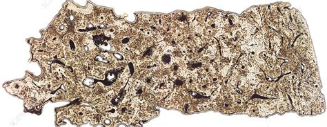 Bone Light Micrograph Stock Image C024 8111 Science Photo Library