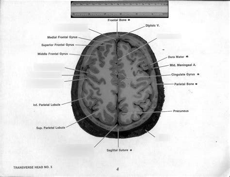CADAVER CROSS SECTIONS FOR HEAD AND NECK Diagram Quizlet