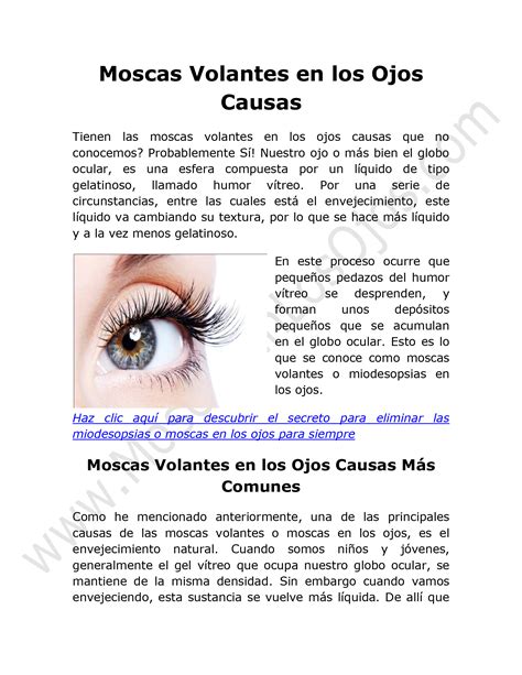 PDF Moscas Volantes En Los Ojos Causas Principales Causas De Las