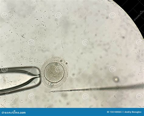 View Through Microscope At In Vitro Fertilization Process Stock Image