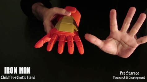3d Printed Prosthetics Iron Man