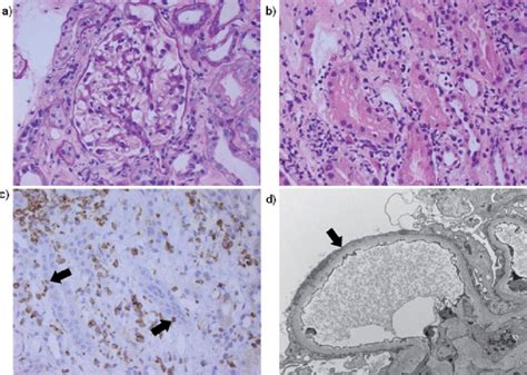 Light And Em A Normal Glomerulus Showing Open Capillary Loops Thin