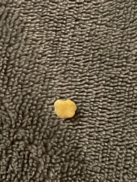 First Stone 😩 It Was Bigger Than This But Couldnt Take All Of It R