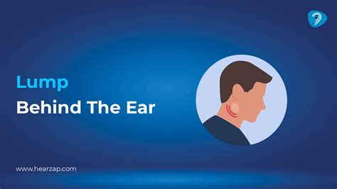 Lump Behind The Ear Causes Symptoms And Treatment