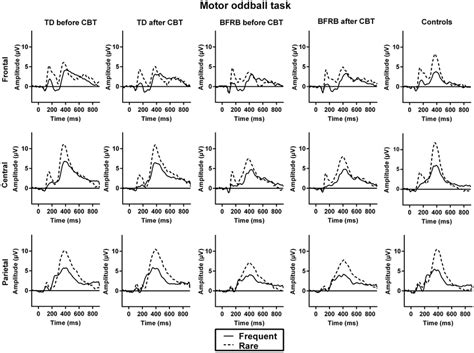 Erp Waveforms During The Motor Oddball Task No Significant Group