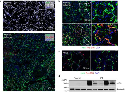 Local Lung Hypoxia Determines Epithelial Fate Decisions During Alveolar