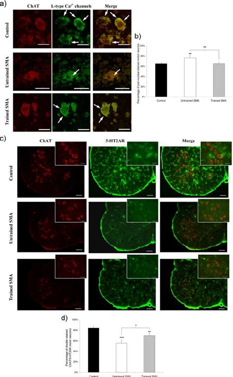 Analysis Of Motor Neuron Postnatal Maturation In Untrained And Trained