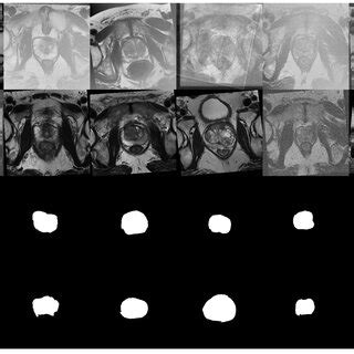 A Results Obtained By The Segmentation Models On Prostate Gland