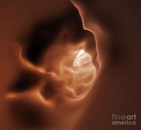 Carotid Artery 3 Photograph By Zephyrscience Photo Library Pixels