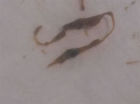 Flat Worms In Humans Qrjolo