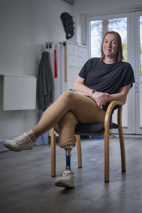 Amputation Foundation Posted On Linkedin